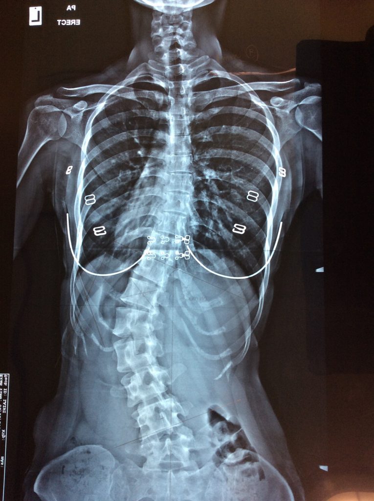 Education – Cyriax Physio